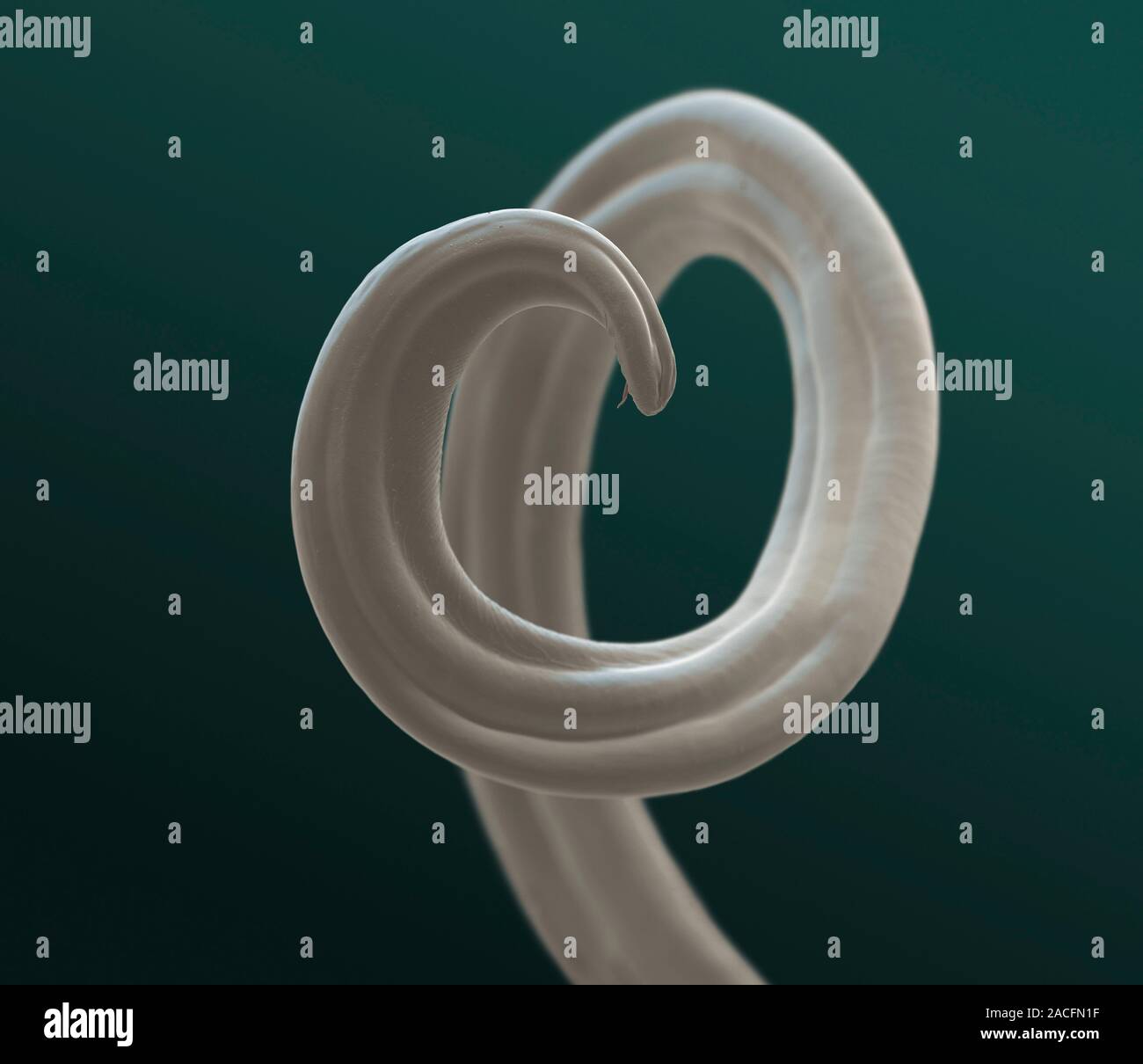 Heartworm. Coloured scanning electron micrograph (SEM) of the tail of a ...