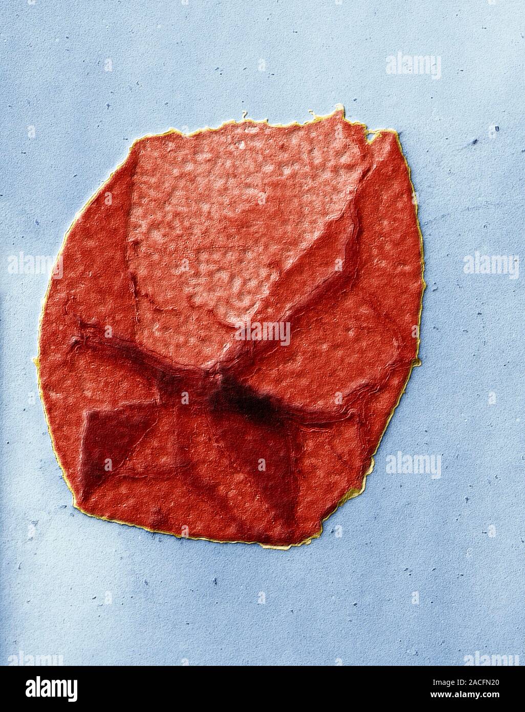Red blood cell destruction. Coloured transmission electron micrograph ...