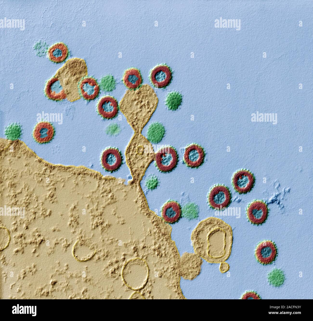 Non-infectious HIV particles. Coloured transmission electron micrograph (TEM) of immature HIV ...