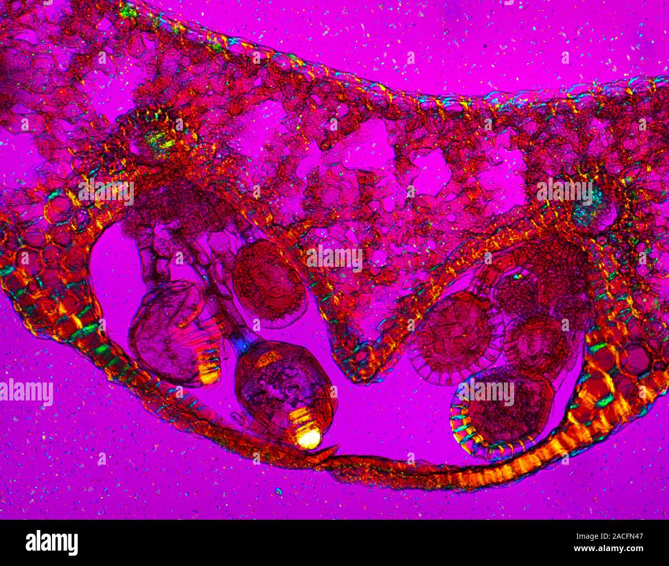 Fern spore capsule, polarised light micrograph. Transverse section ...