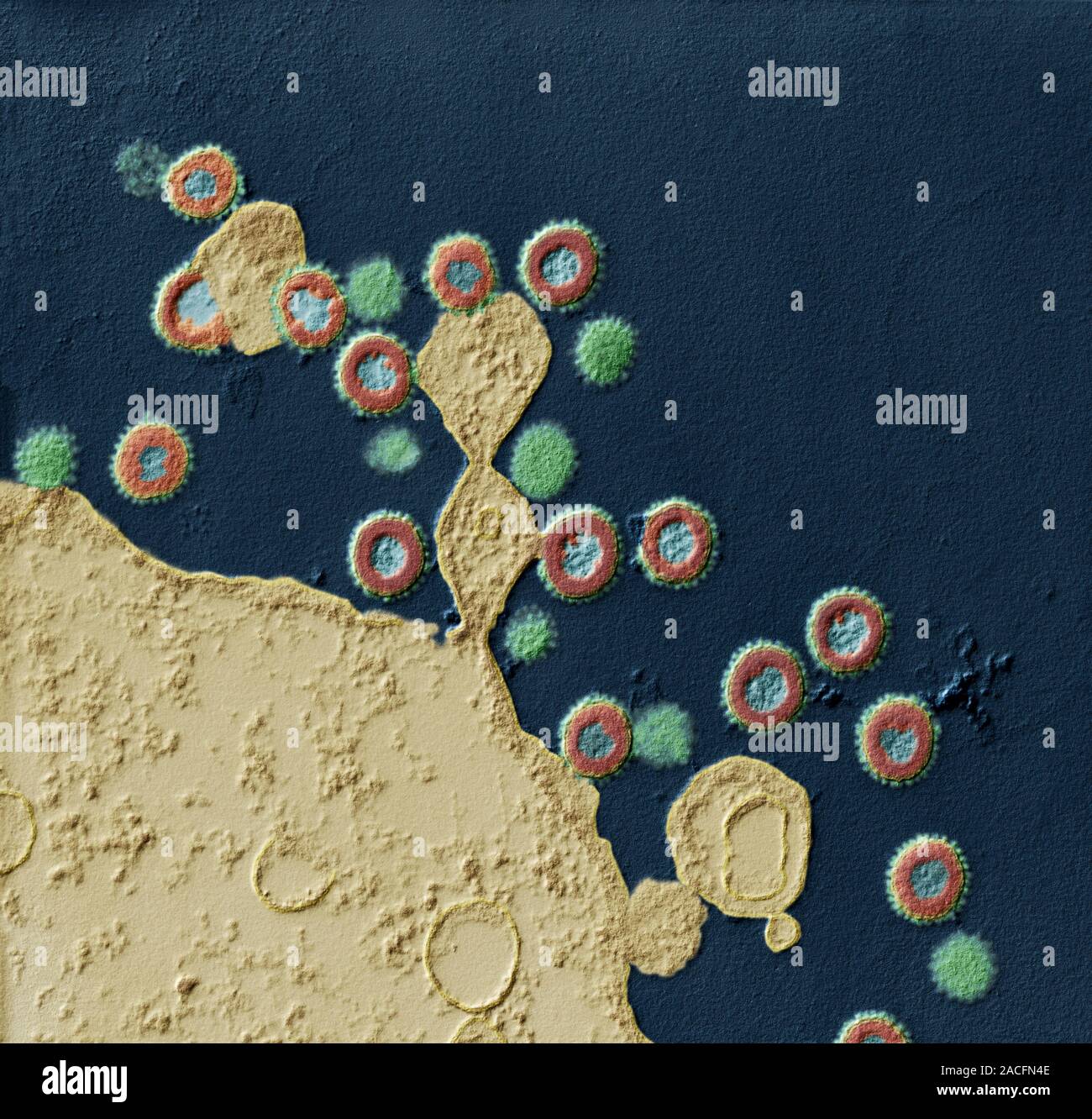 Non-infectious HIV particles. Coloured transmission electron micrograph (TEM) of immature HIV ...