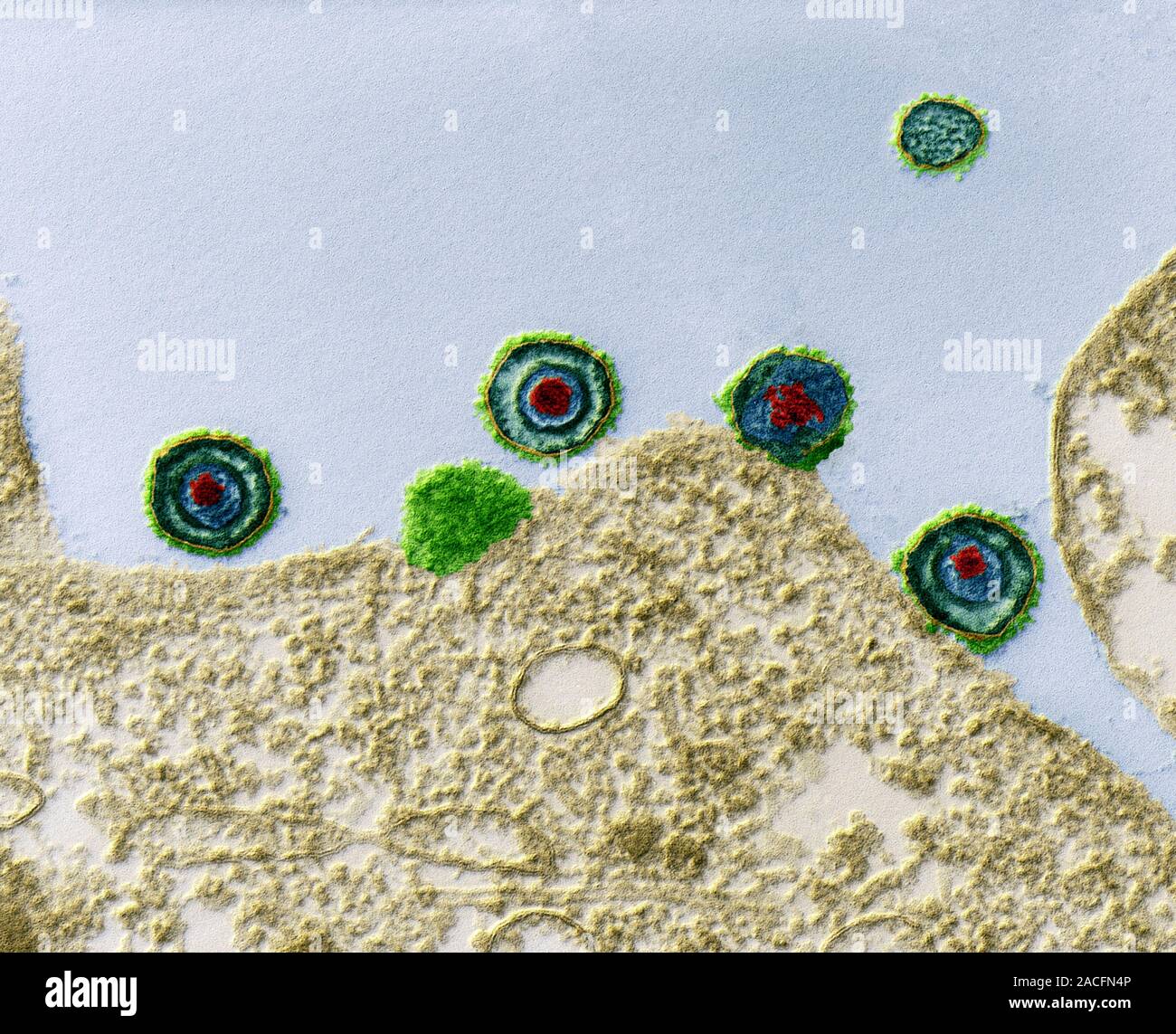Herpes simplex virus particles, coloured transmission electron ...
