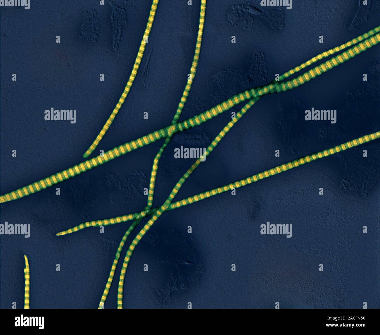 Collagen fibres, coloured transmission electron micrograph (TEM ...