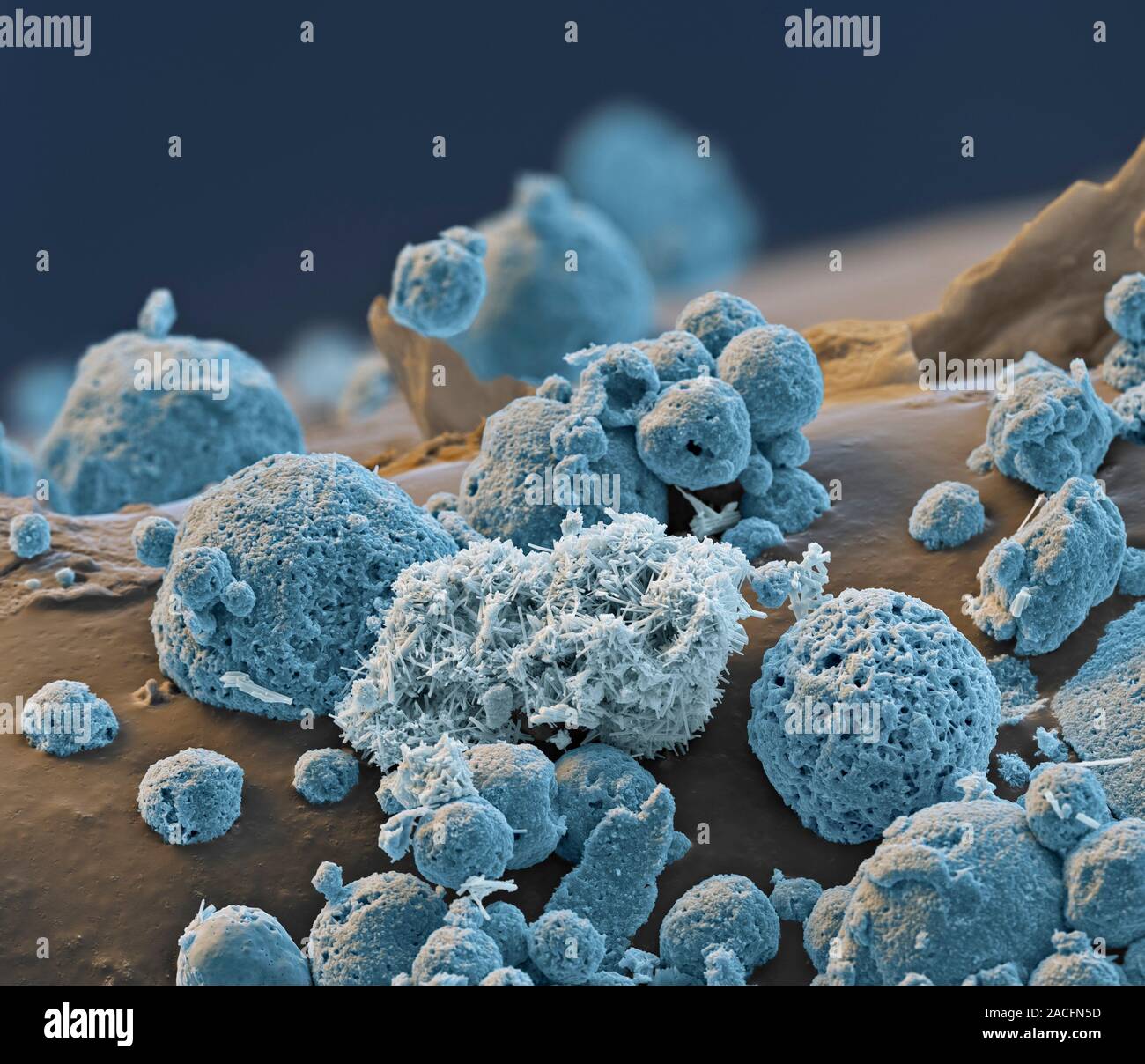 Lithium-ion crystals (blue), coloured scanning electron microscope (SEM ...