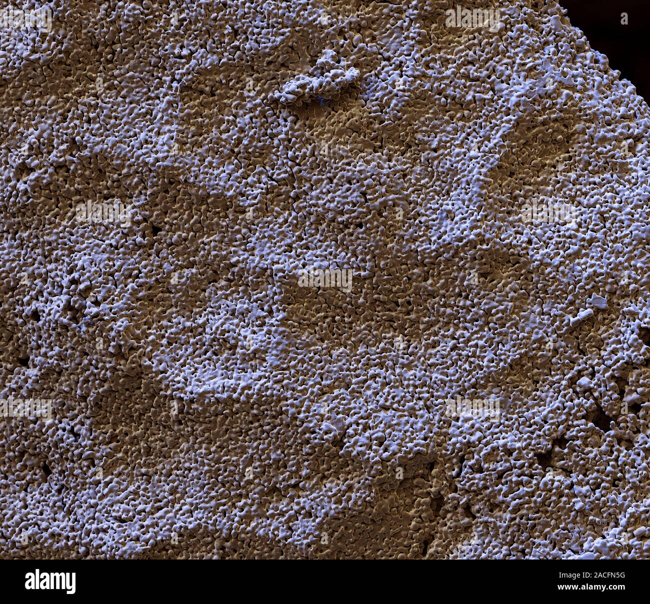 Metal foam. Coloured scanning electron microscope (SEM) of foamed ...