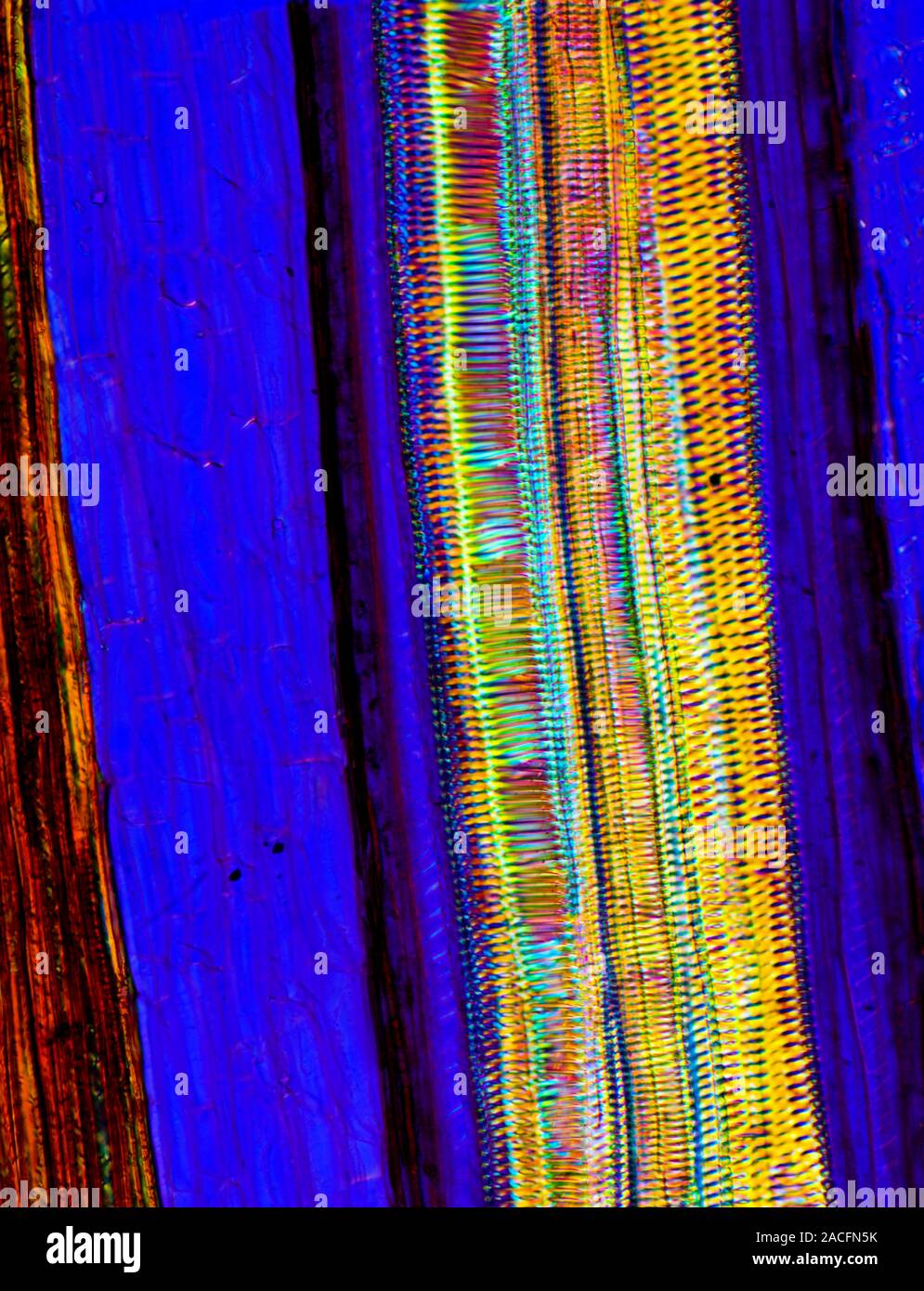 Fern rhizome, polarised light micrograph. Longitudinal section through ...