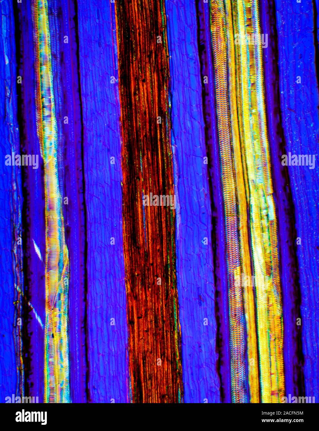 Fern rhizome, polarised light micrograph. Longitudinal section through ...