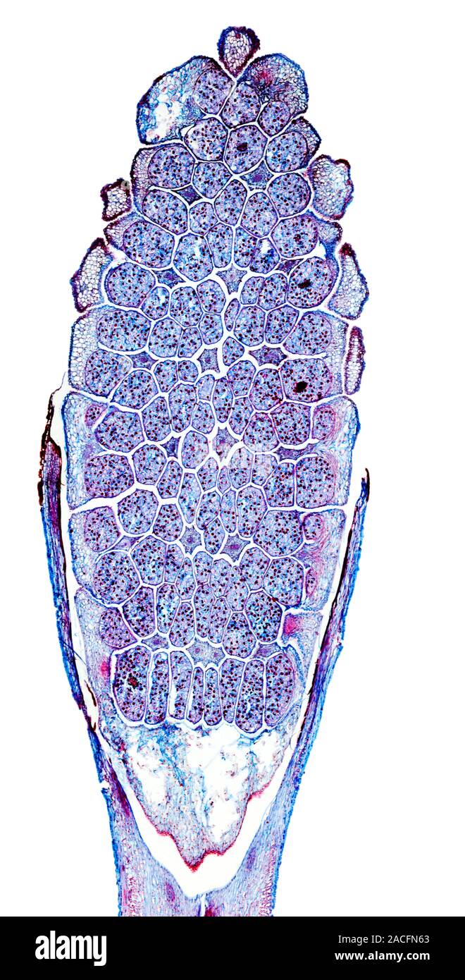 Horsetail cone, light micrograph. Longitudinal section through a young ...
