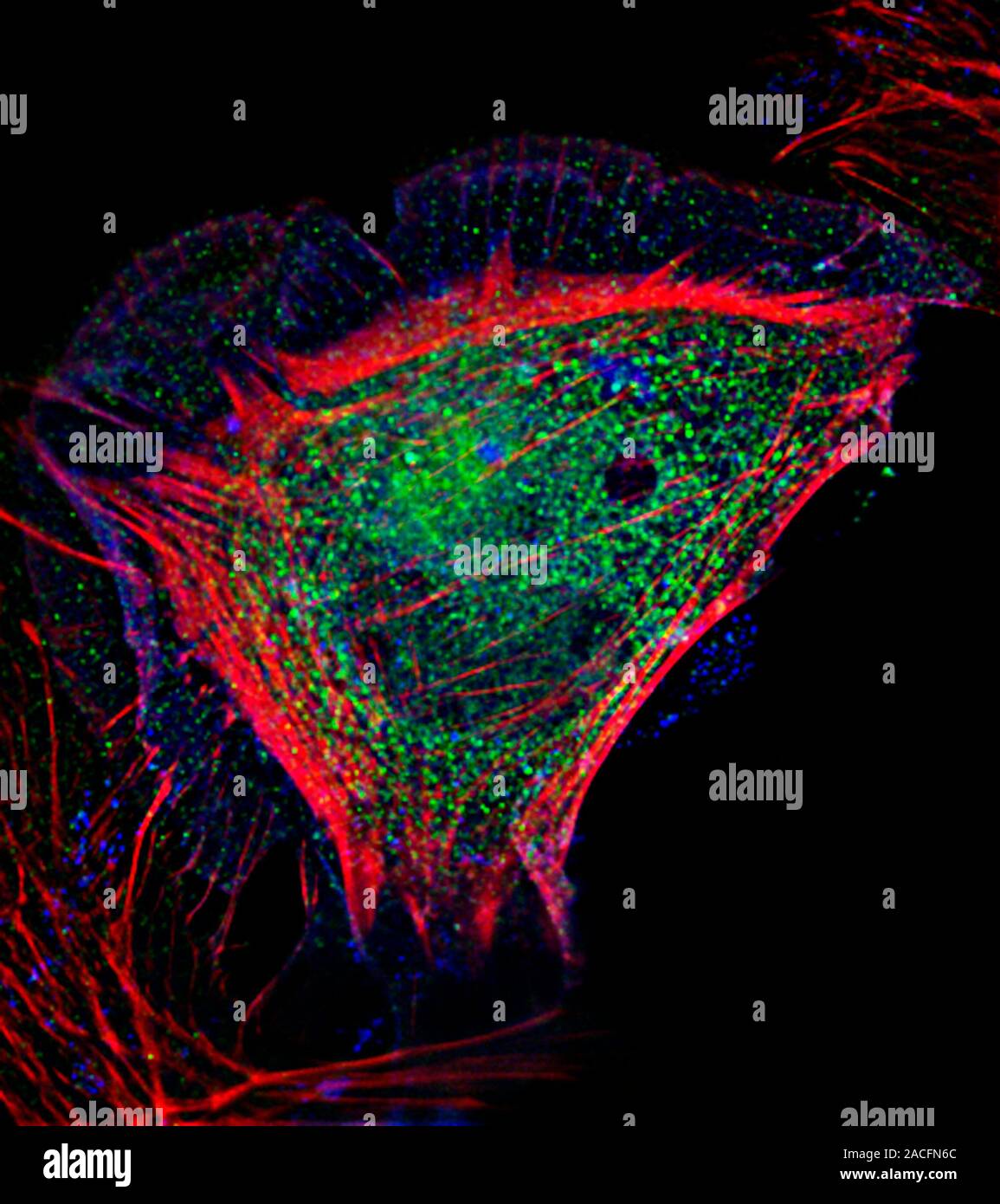 Astrocyte nerve cell, immunofluorescence deconvolution micrograph. The ...