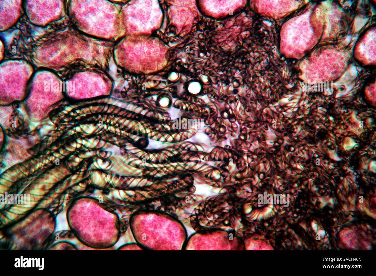 Liverwort spore elaters, light micrograph. Transverse section through ...