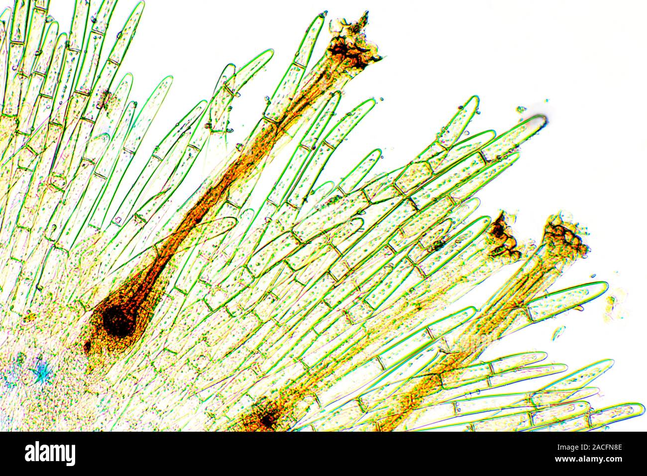 Moss reproductive parts, polarised light micrograph. Longitudinal ...