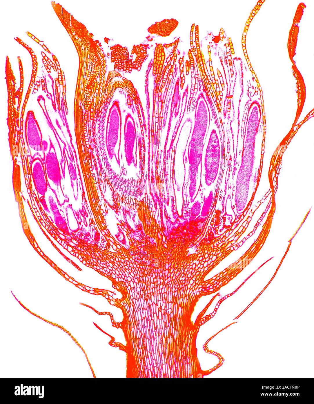 Moss reproductive parts, light micrograph. Longitudinal section through ...