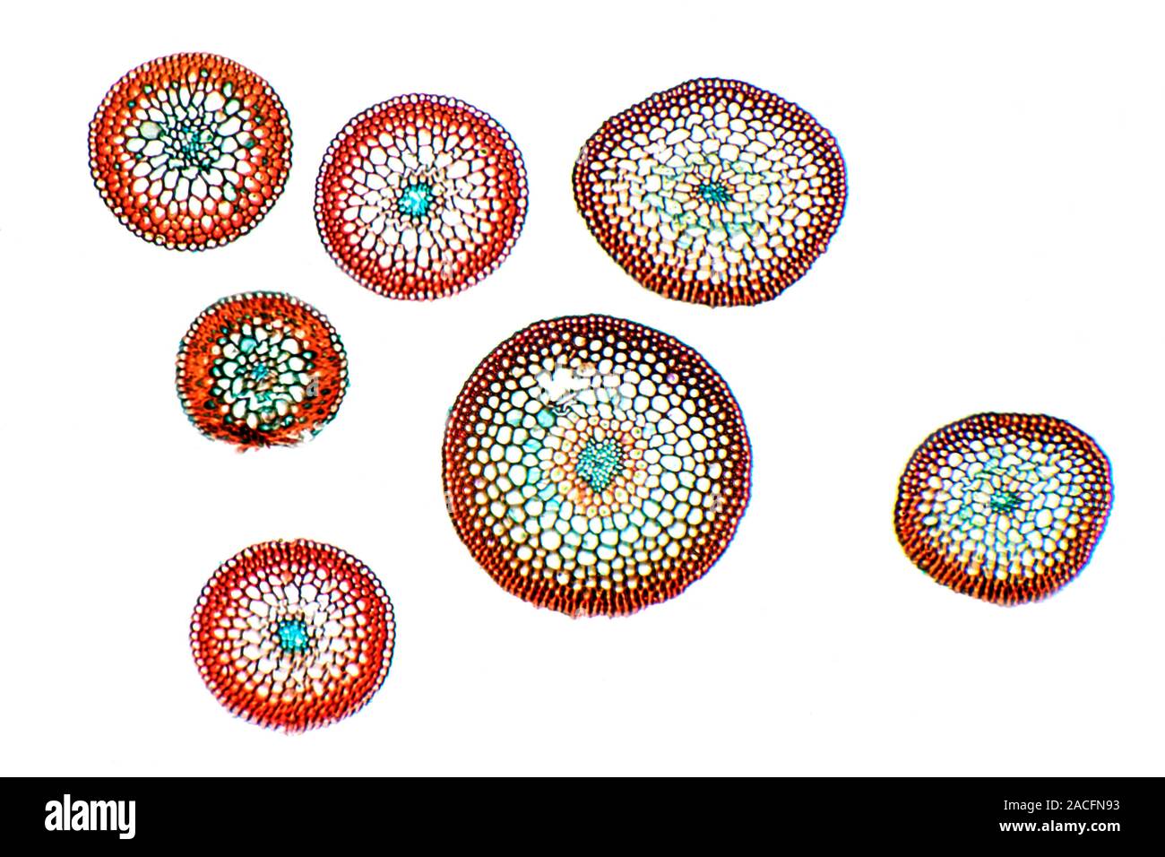 Moss stems, light micrograph. Transverse section through stems of a ...