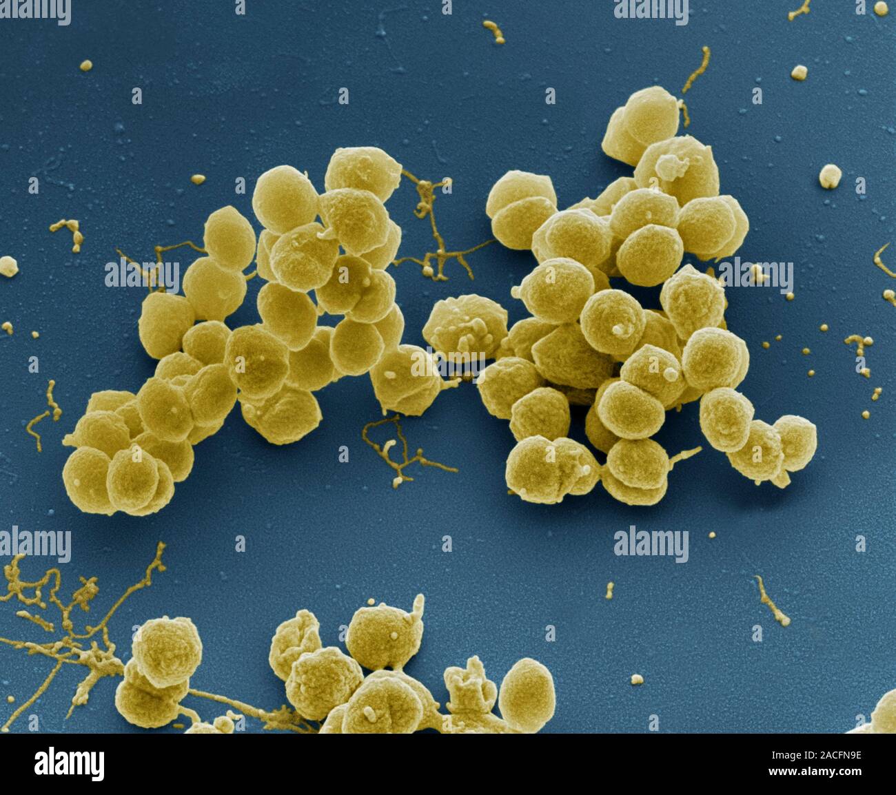 Meningitis bacteria. Coloured scanning electron micrograph (SEM) of ...