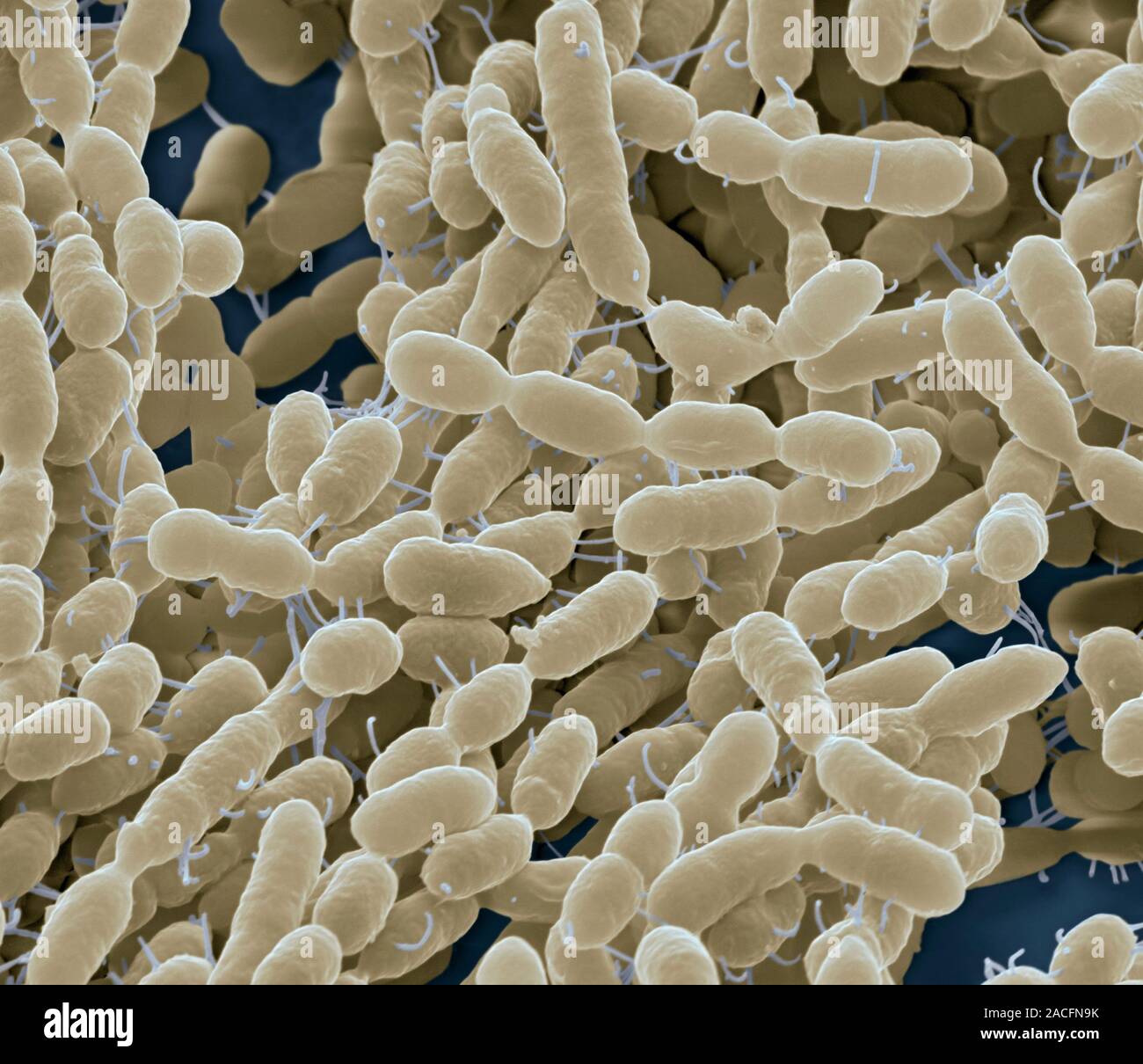 Pasteurella multocida