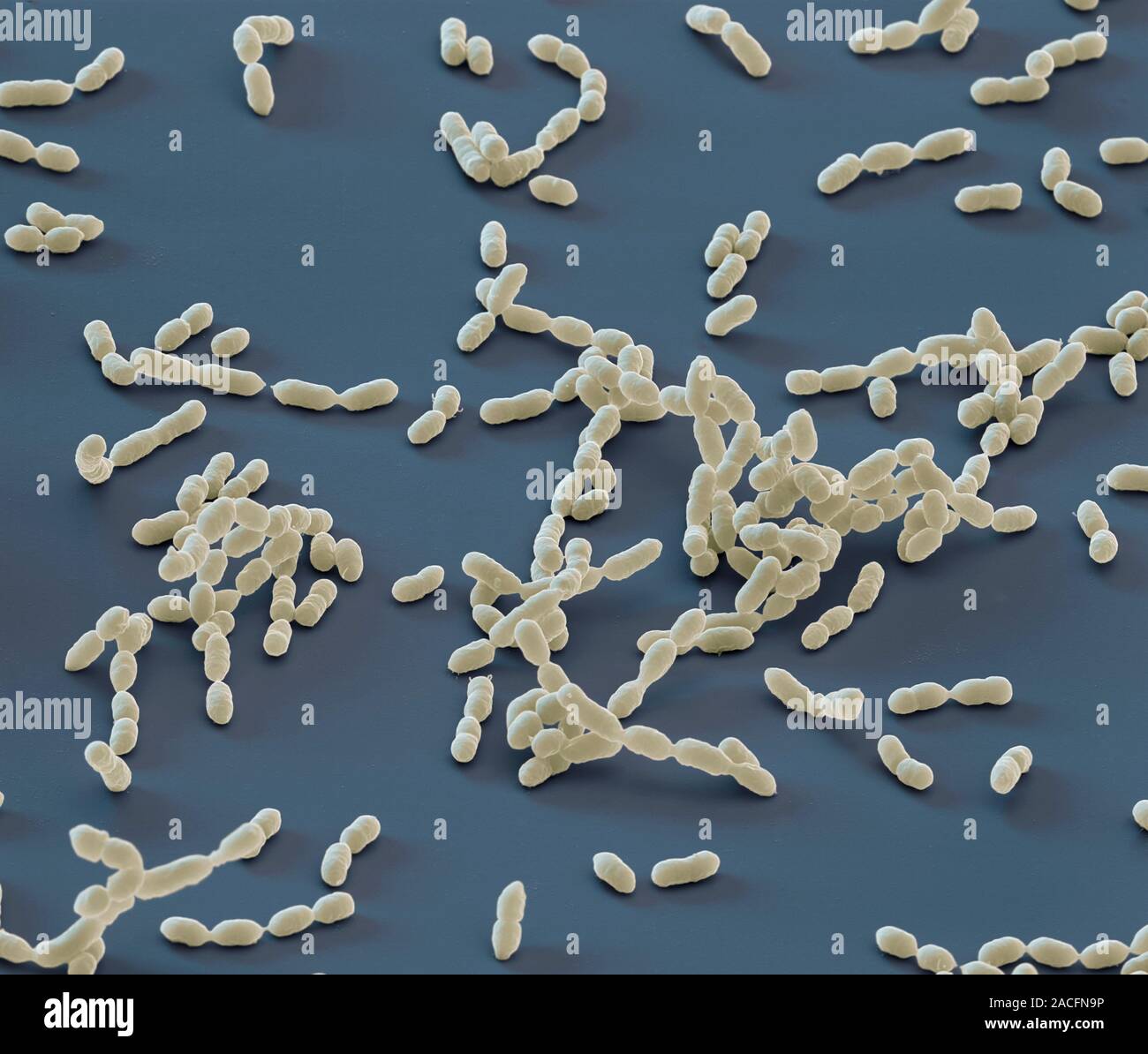 Pasteurella bacteria, coloured scanning electron micrograph (SEM ...