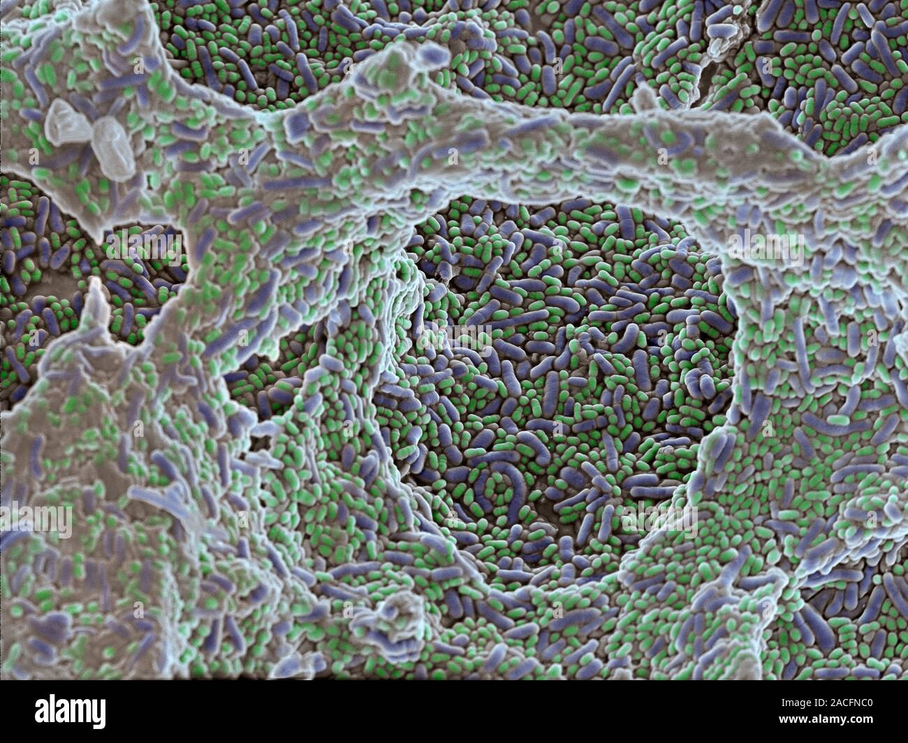 Lactobacillus paracasei bacteria (purple), coloured scanning electron ...