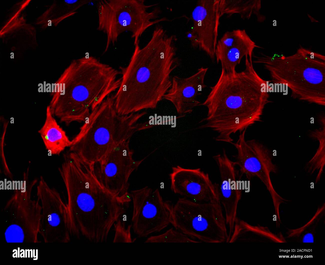 Fibroblast cells. Immunofluorescence deconvolution micrograph of ...