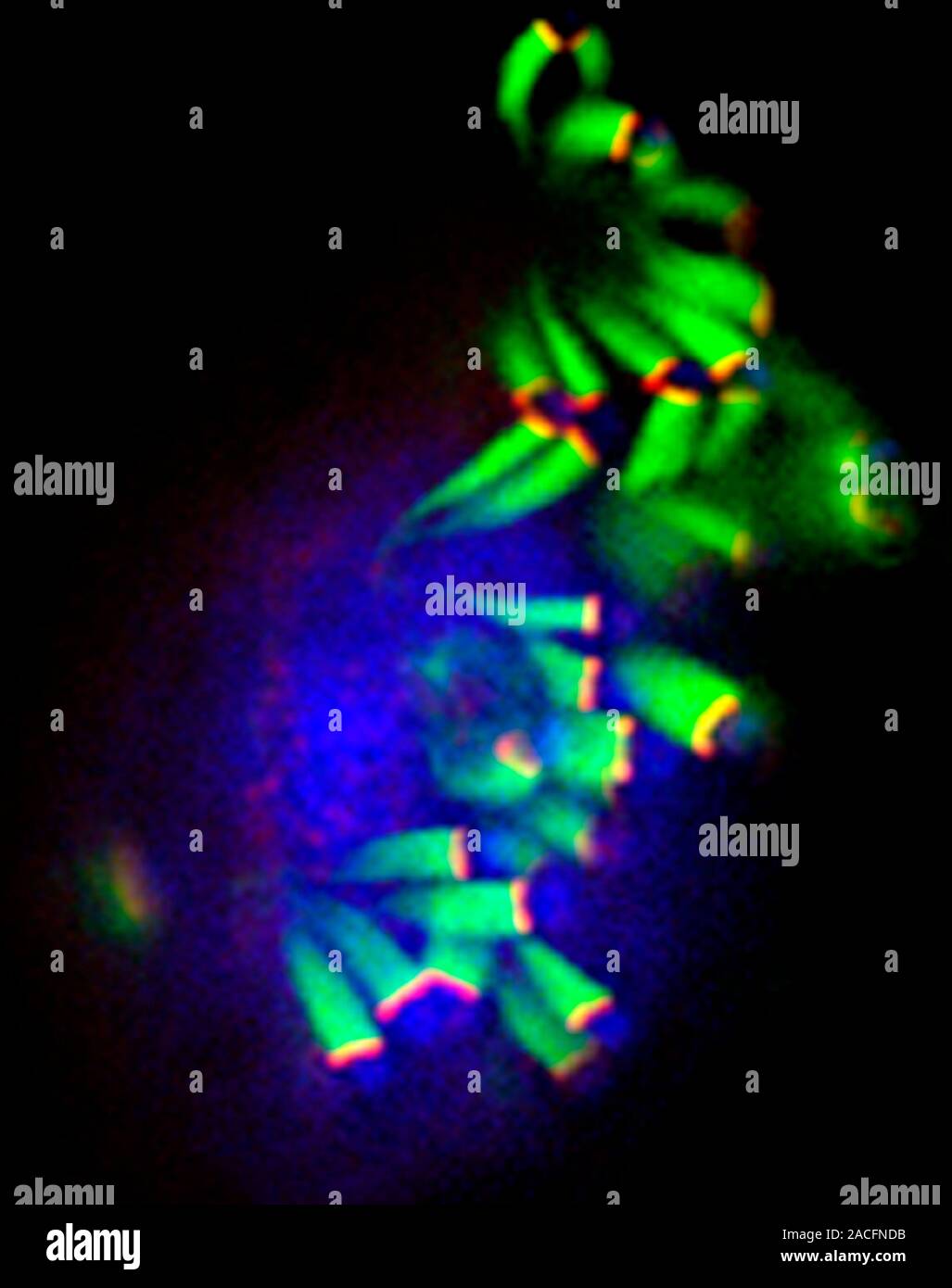 E. coli infection mechanism. Immunofluorescence deconvolution ...