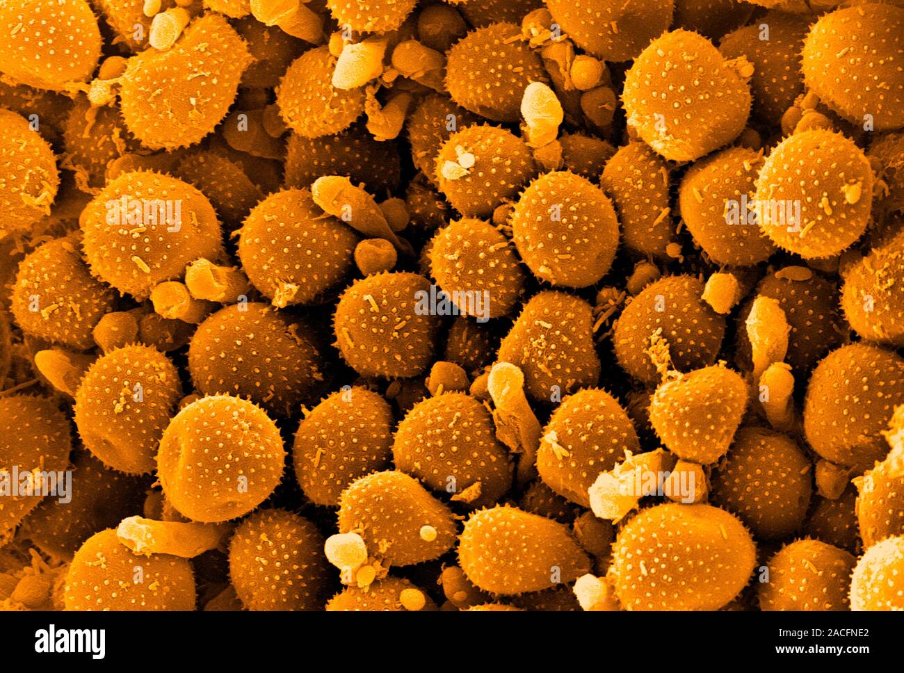 Bean rust (Uromyces sp.) spores, coloured scanning electron micrograph ...