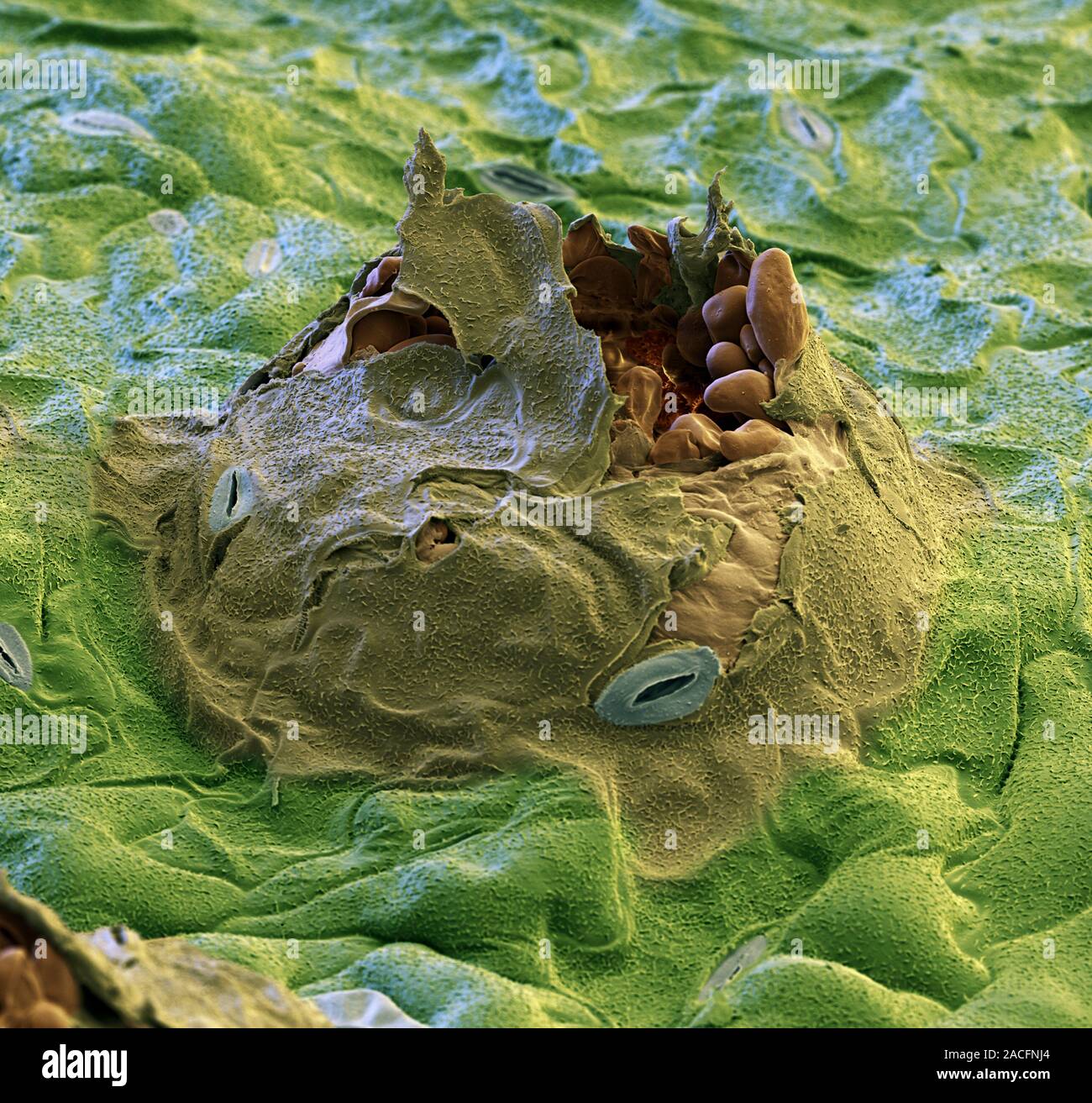 Leaf infected with rust fungus. Coloured scanning electron micrograph ...