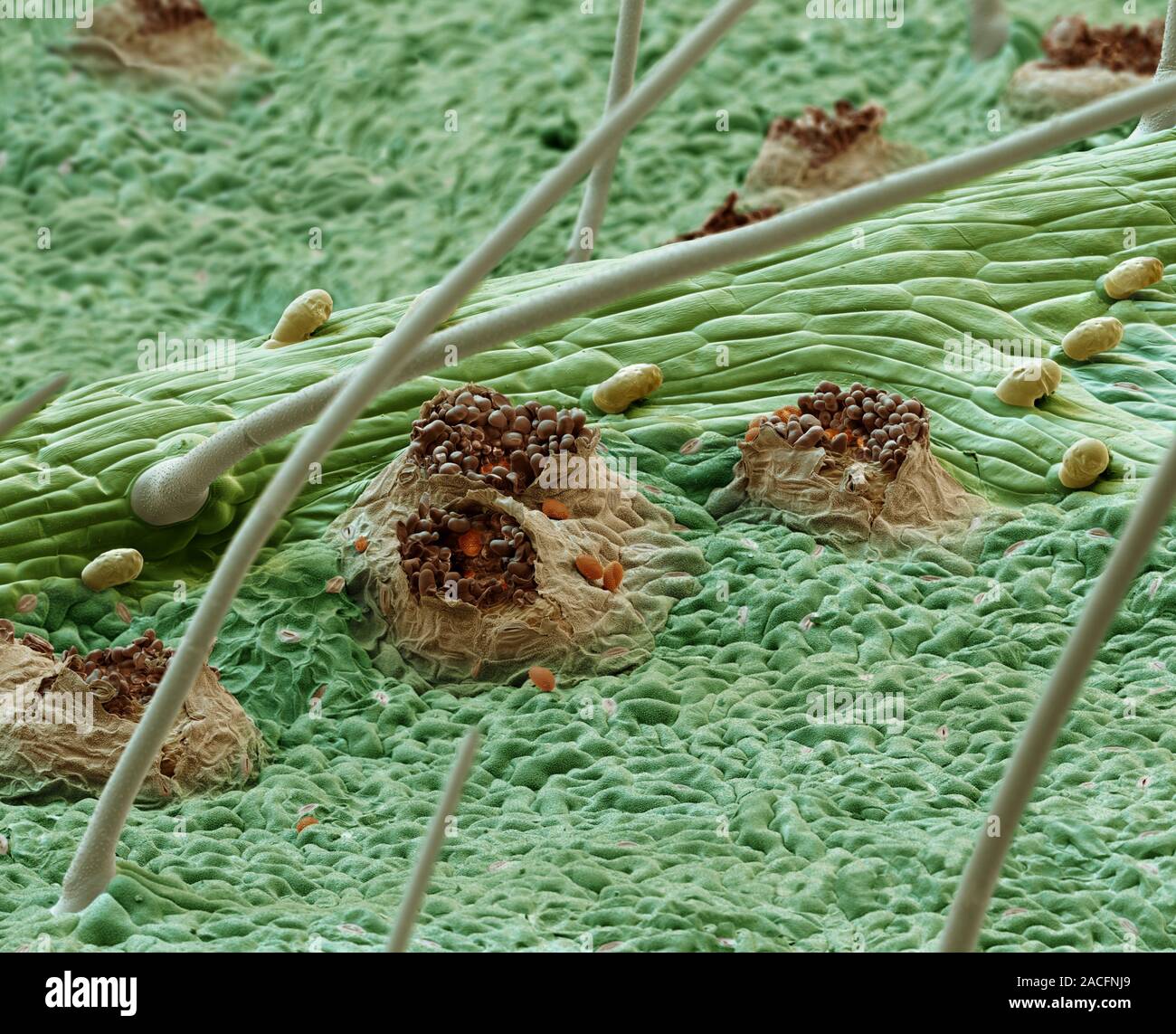 Leaf infected with rust fungus. Coloured scanning electron micrograph ...