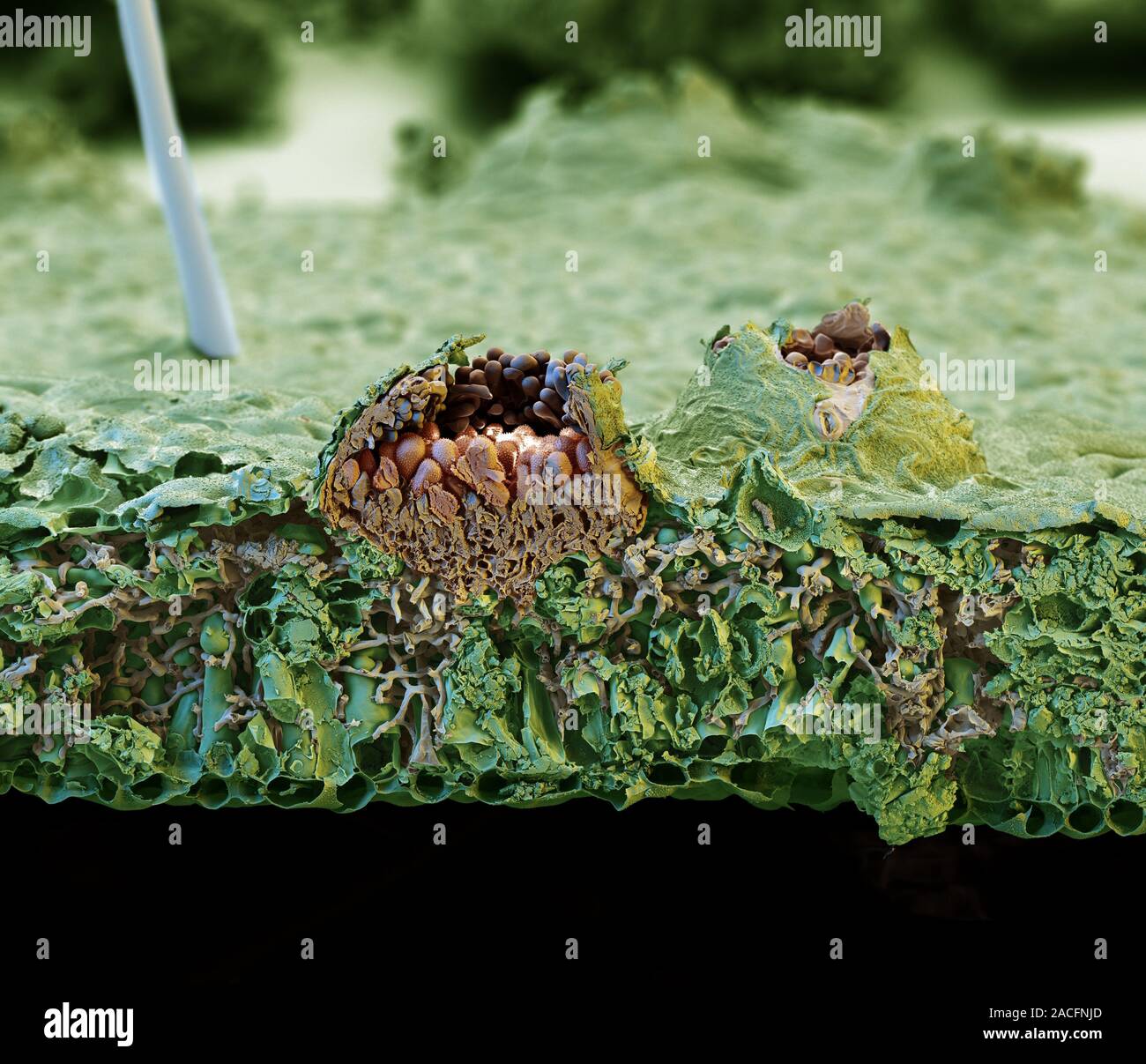 Leaf infected with rust fungus. Coloured scanning electron micrograph ...