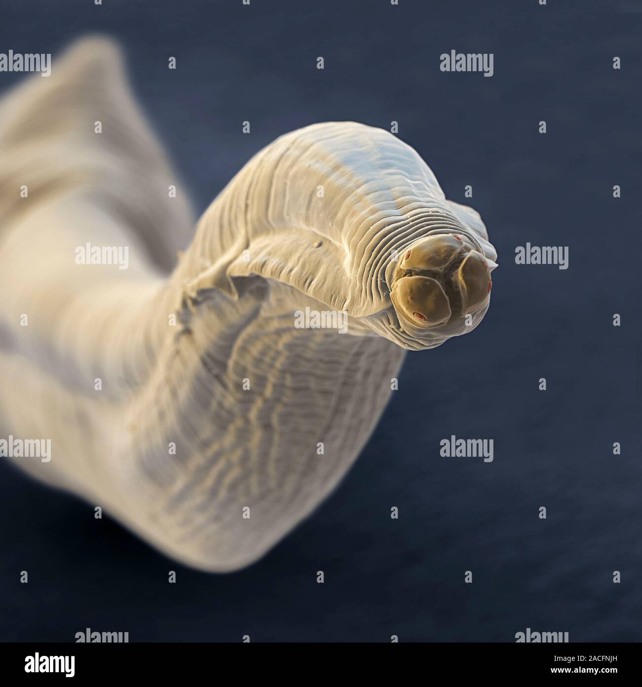 Dog roundworm. Coloured scanning electron micrograph (SEM) showing the ...