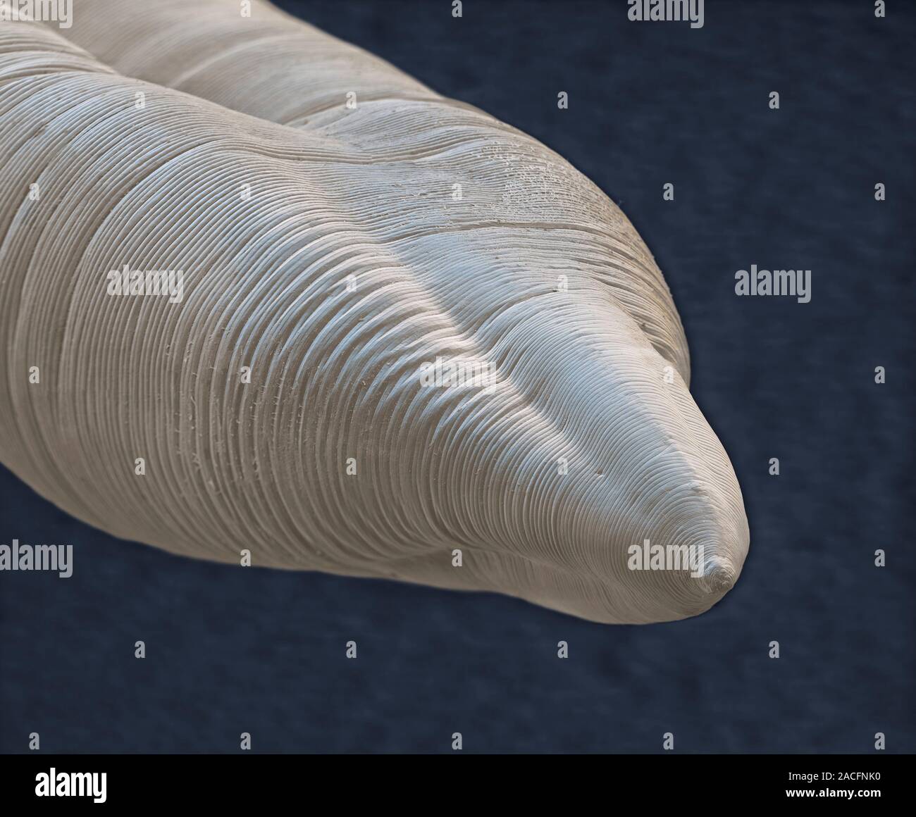 Dog roundworm. Coloured scanning electron micrograph (SEM) showing the ...