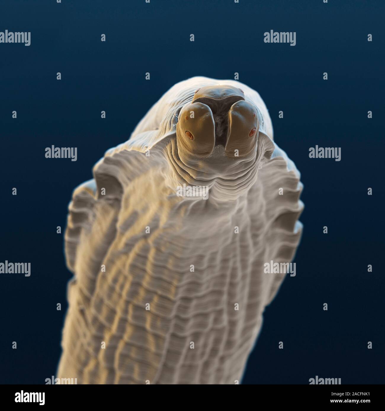 Dog roundworm. Coloured scanning electron micrograph (SEM) showing the ...