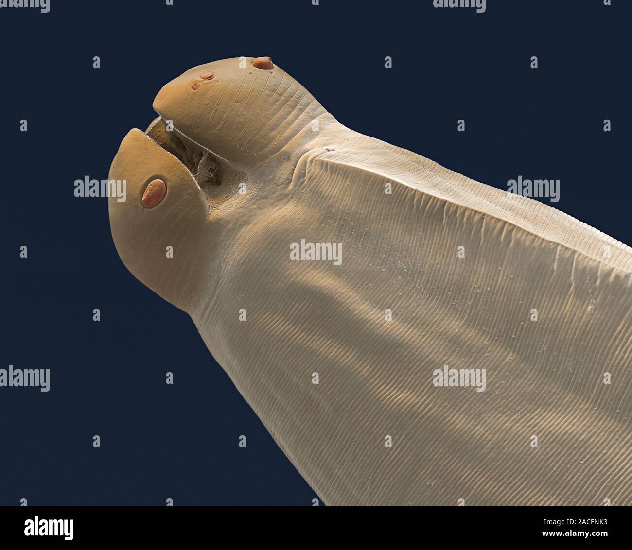 Dog roundworm. Coloured scanning electron micrograph (SEM) showing the ...