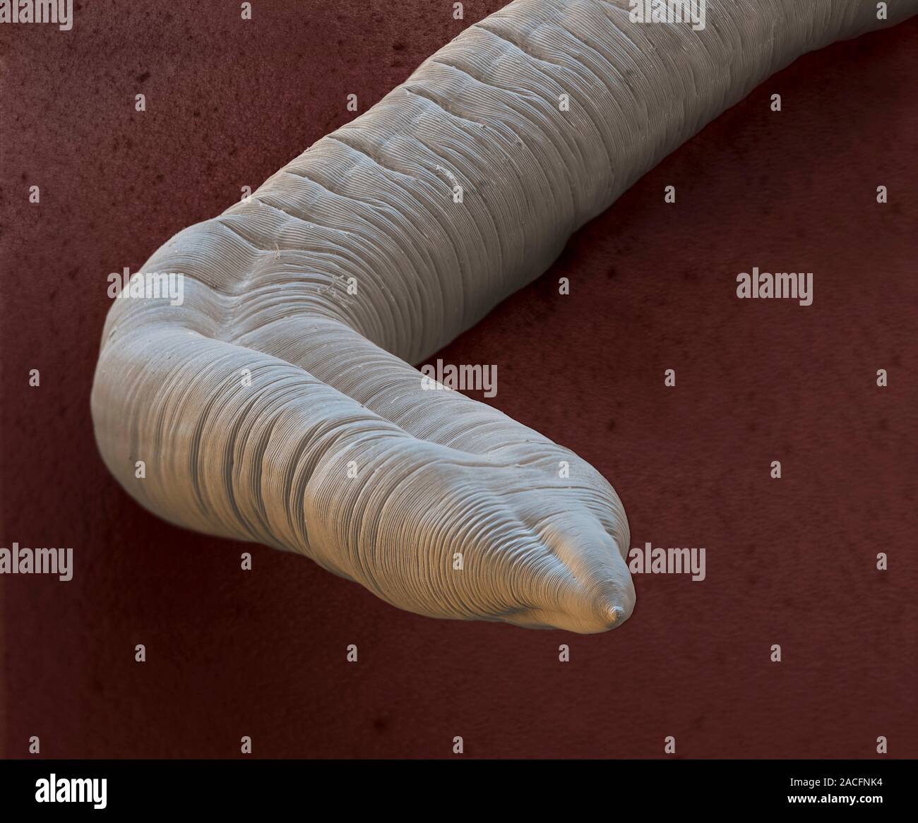 Dog roundworm. Coloured scanning electron micrograph (SEM) showing the ...