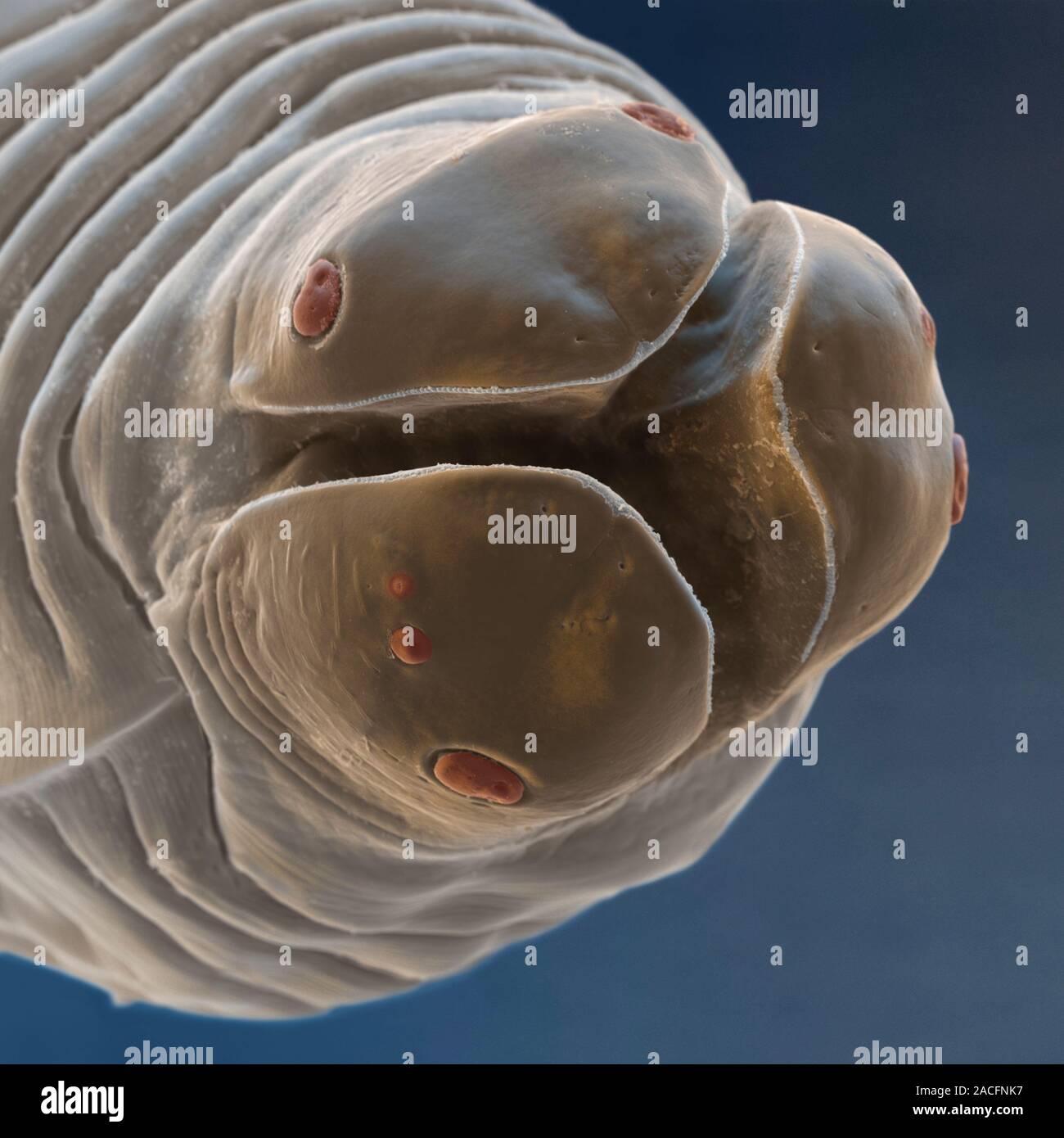 Dog roundworm. Coloured scanning electron micrograph (SEM) showing the ...