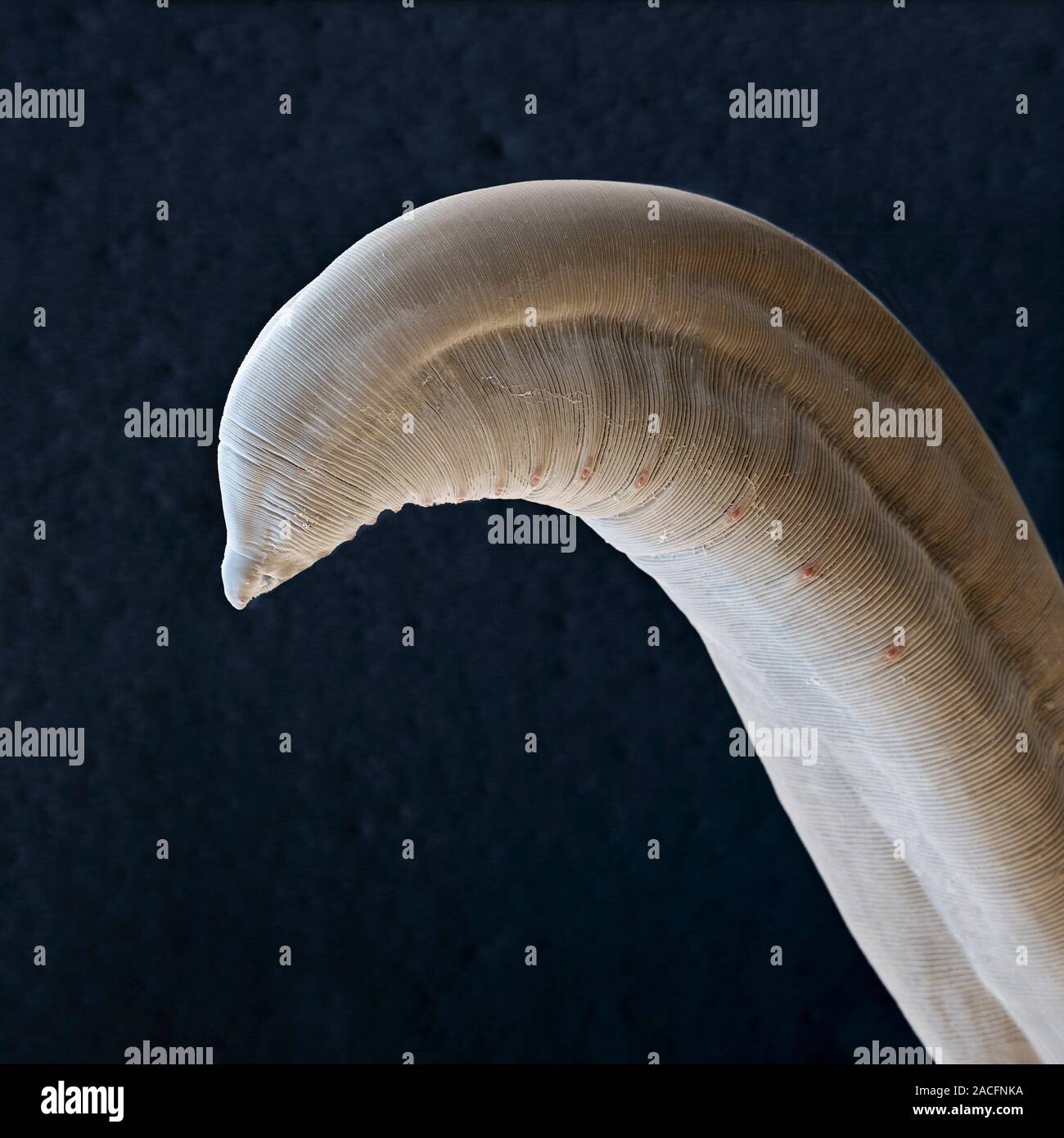 Dog roundworm. Coloured scanning electron micrograph (SEM) showing the ...
