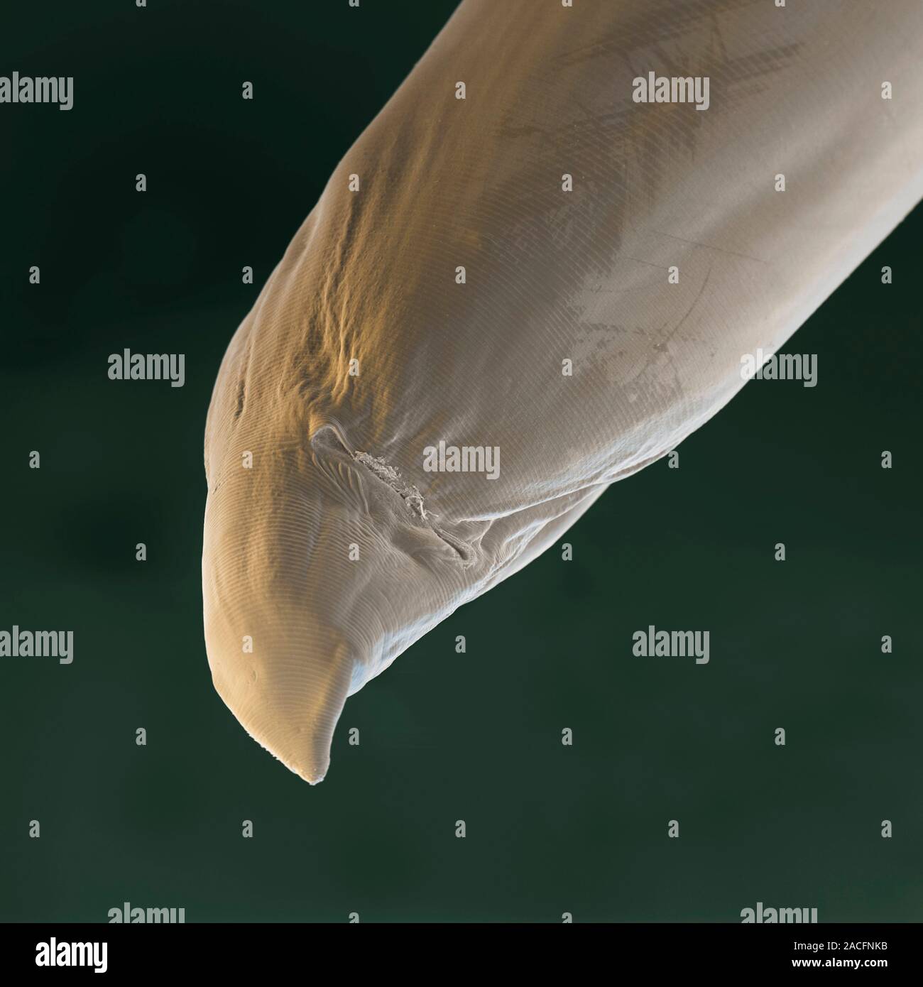 Dog roundworm. Coloured scanning electron micrograph (SEM) showing the ...