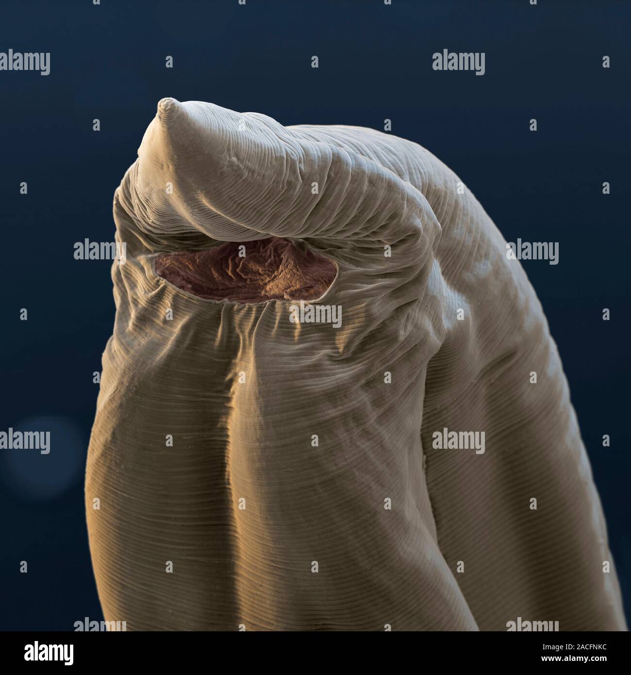 Dog roundworm. Coloured scanning electron micrograph (SEM) showing the ...