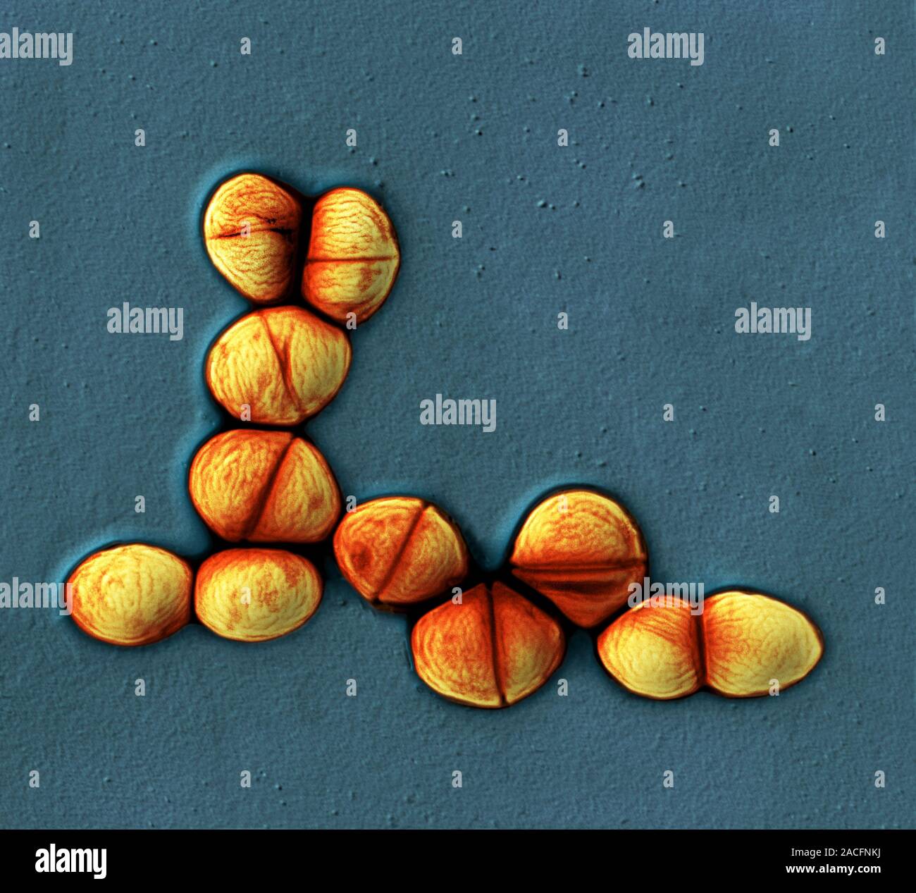 Streptococcus Pneumoniae Electron Micrograph