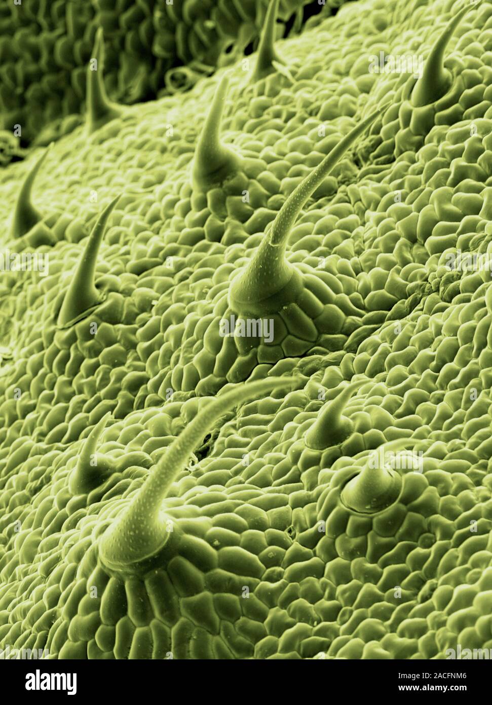 Stinging nettle (Urtica dioica) leaf trichomes, coloured scanning ...