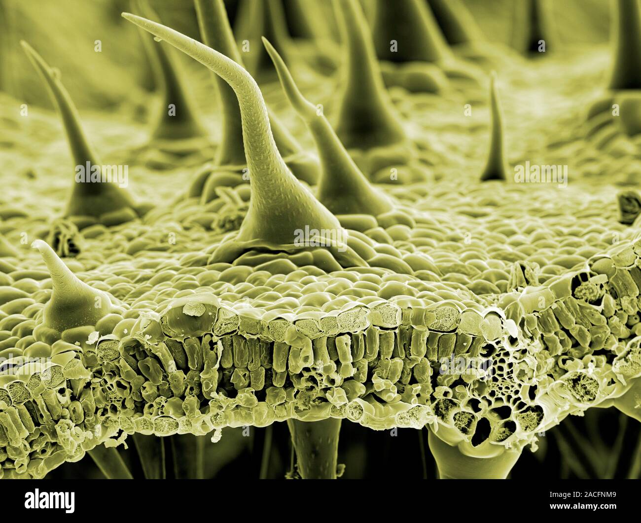 Stinging nettle (Urtica dioica) leaf trichomes, coloured scanning ...