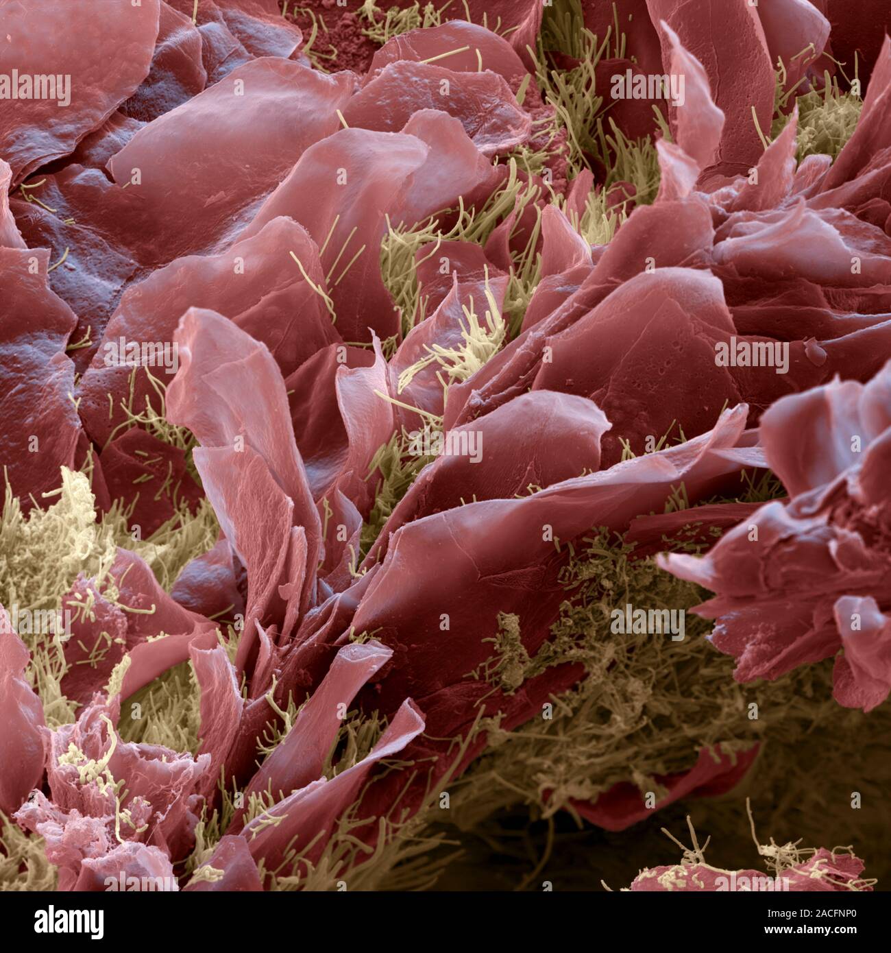 Human tongue surface with bacteria. Coloured scanning electron ...