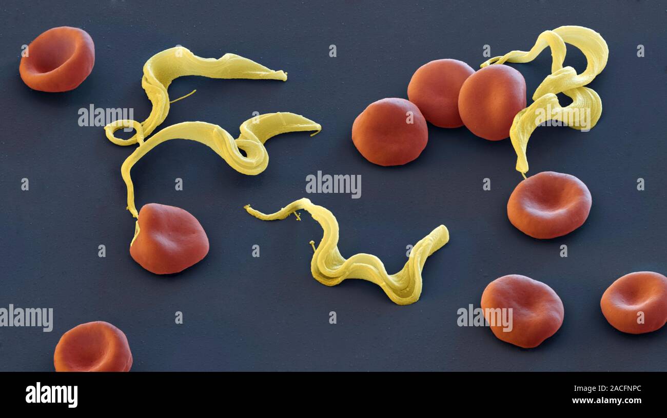 Sleeping sickness parasites. Coloured scanning electron micrograph (SEM ...