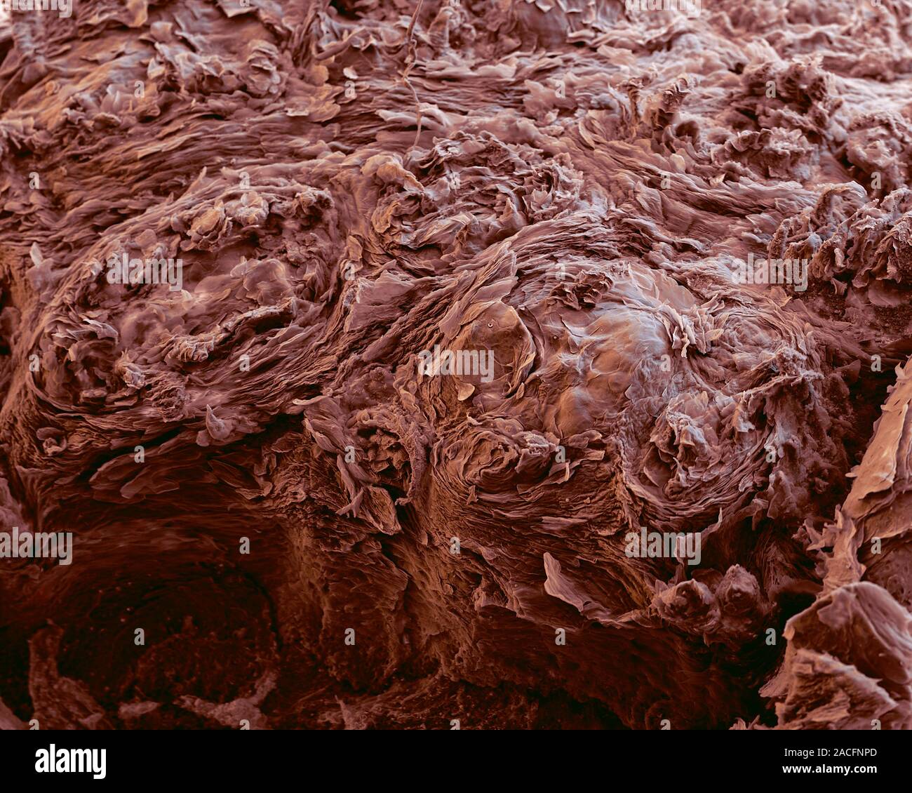Human tongue surface. Coloured scanning electron micrograph (SEM) of ...