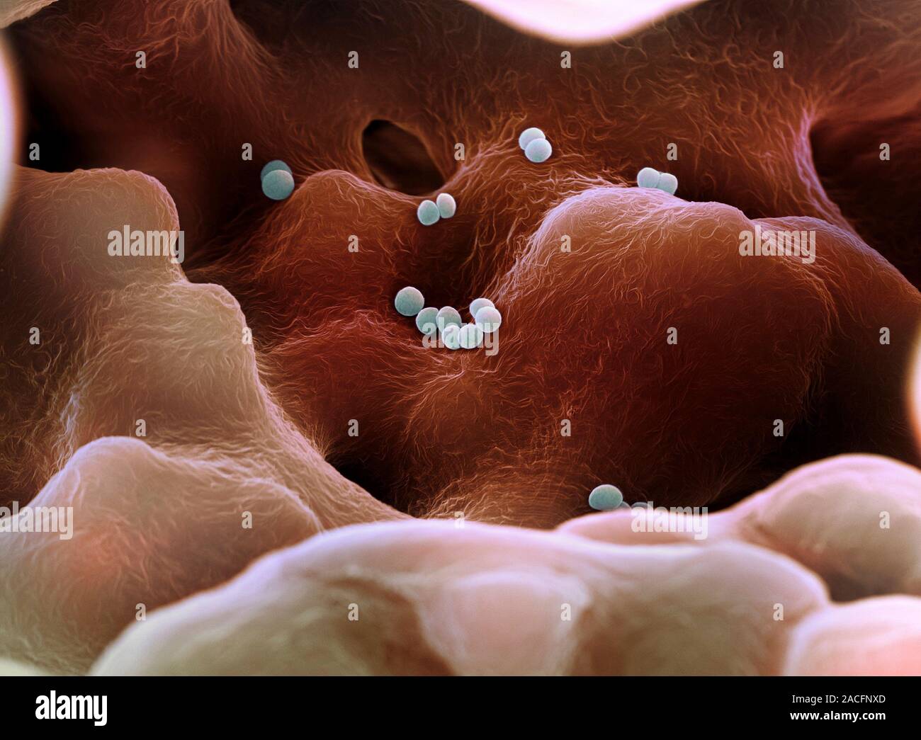 MRSA bacteria, coloured scanning electron micrograph (SEM). Methicillin-resistant Staphylococcus ...