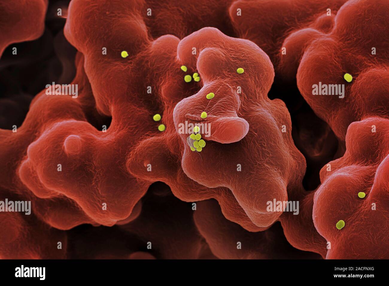 MRSA bacteria, coloured scanning electron micrograph (SEM). Methicillin-resistant Staphylococcus ...