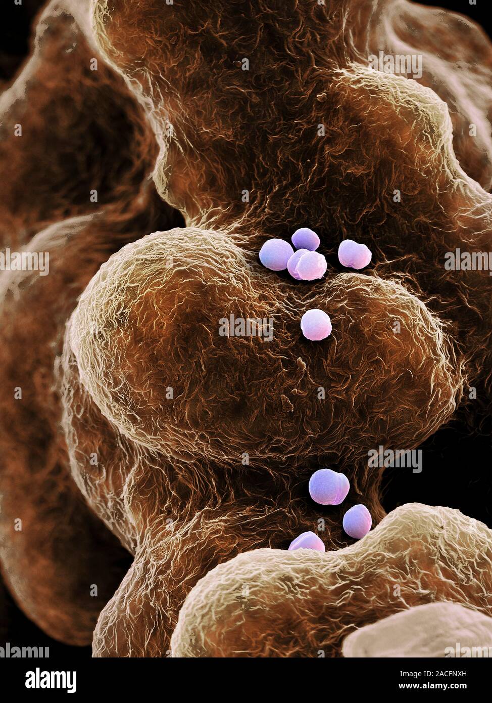 MRSA bacteria, coloured scanning electron micrograph (SEM). Methicillin ...