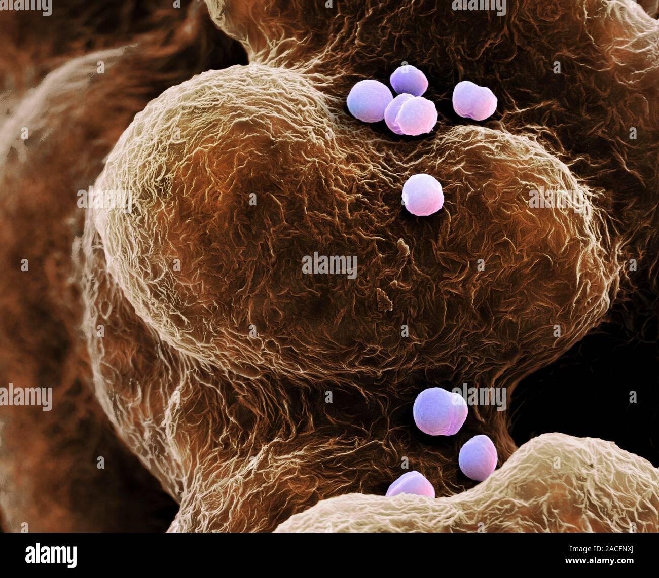 MRSA bacteria, coloured scanning electron micrograph (SEM). Methicillin-resistant Staphylococcus ...