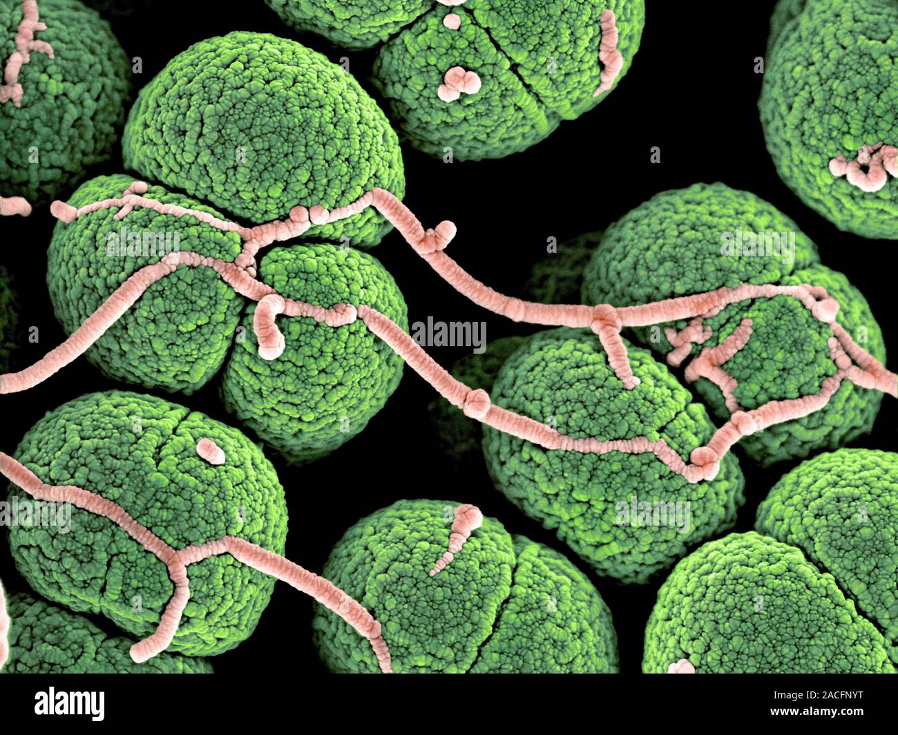 Soil bacteria. Scanning electron micrograph (SEM) of the soil bacteria ...