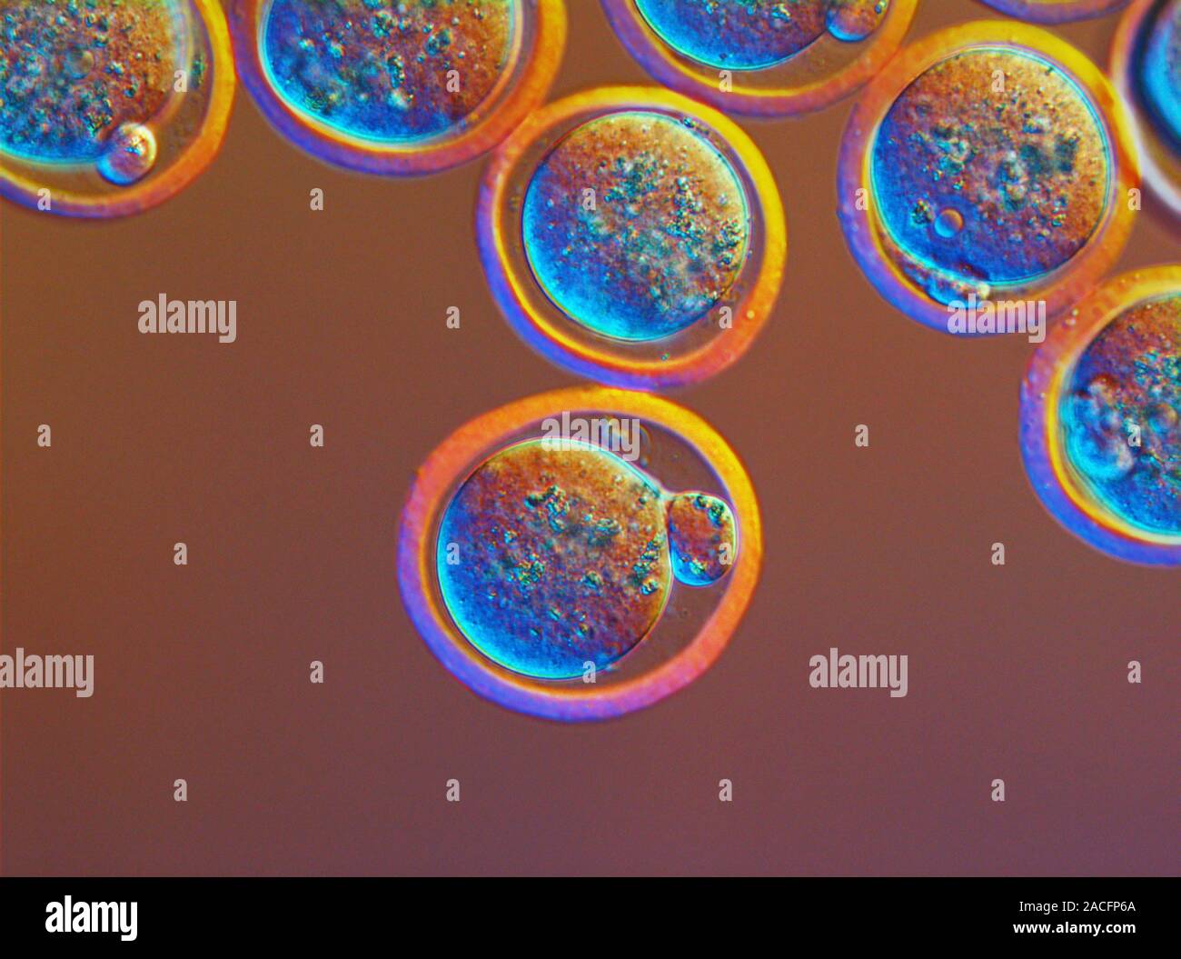 Pronuclear egg cells. Polarised light micrograph of eggs (female ...