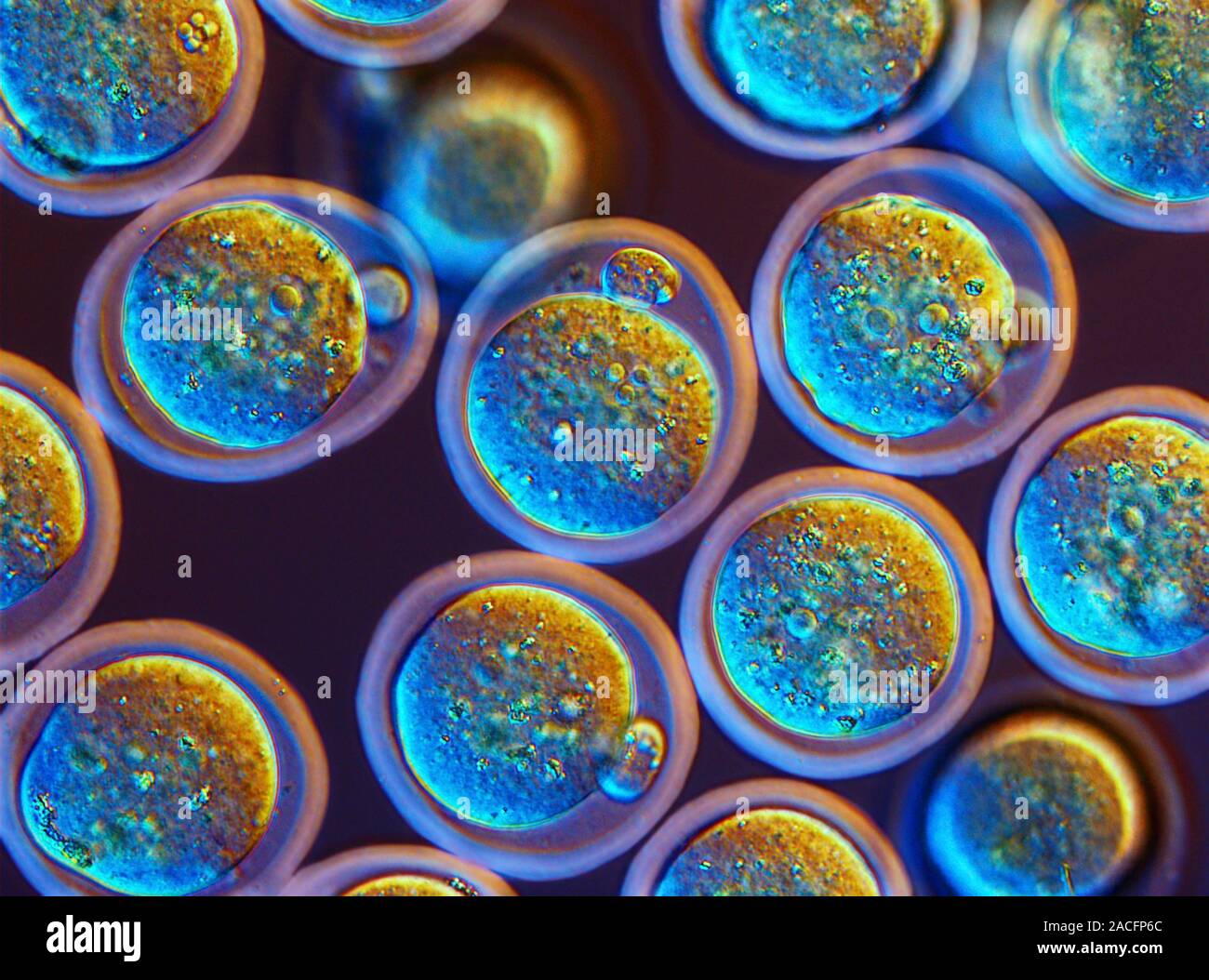 Pronuclear egg cells. Polarised light micrograph of eggs (female ...