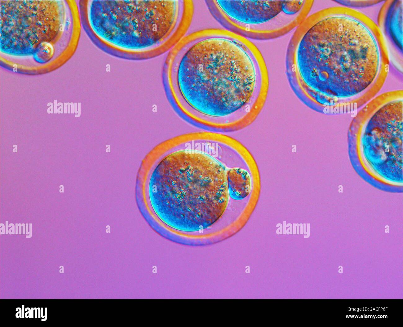 Pronuclear egg cells. Polarised light micrograph of eggs (female ...